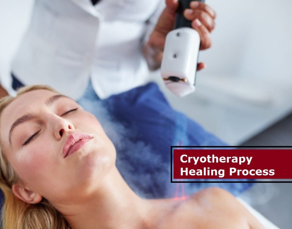 Cryotherapy Stages of Healing: A Comprehensive Guide | Find Family ...